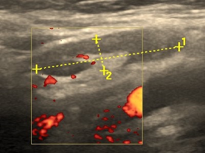 Pomiary – USG Gdańsk-Osowa